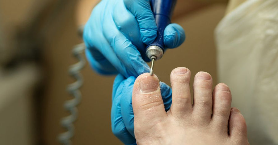 Should I Be Concerned About a Lump or Bump on My Foot? – Foot HQ ...